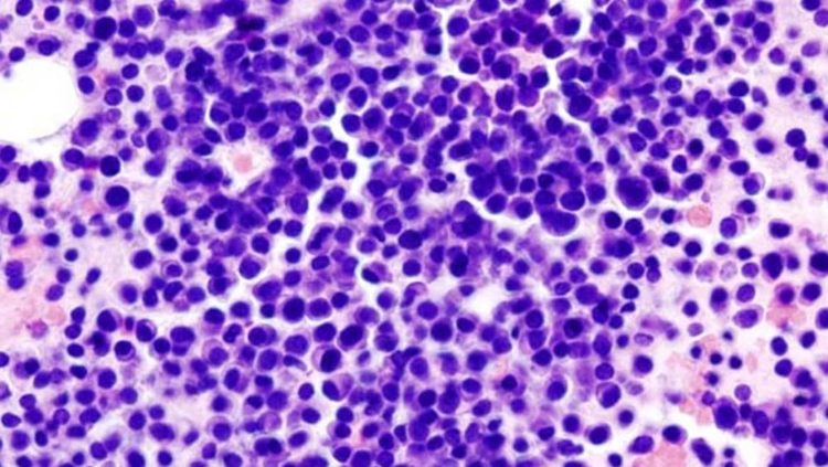 AbbVie and Teneobio to Develop a New Treatment for Multiple Myeloma