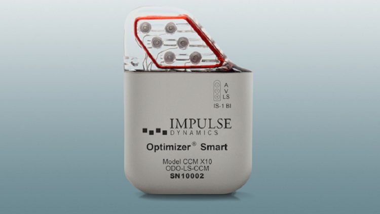 Impulse Dynamics announces successful implantation of first patient ...